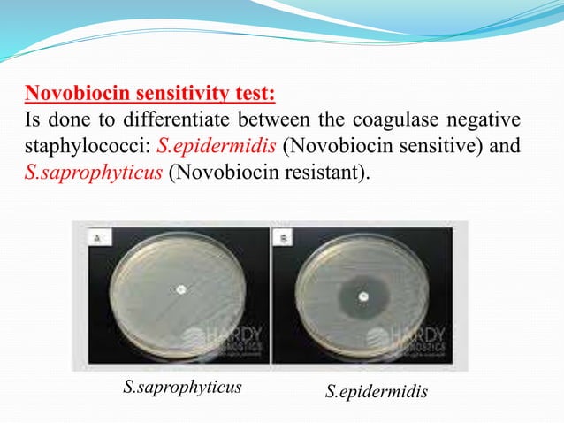 staph.pptx | Infectious Diseases | Diseases and Conditions