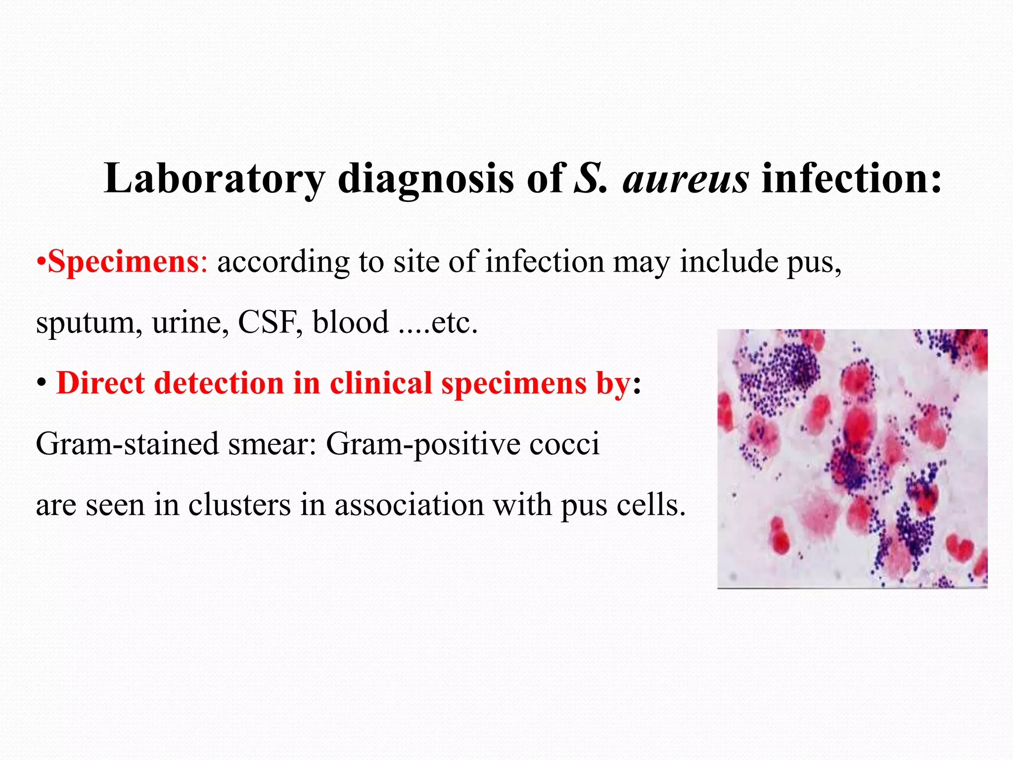 staph, anthrax& strept.pptx | Infectious Diseases | Diseases and Conditions