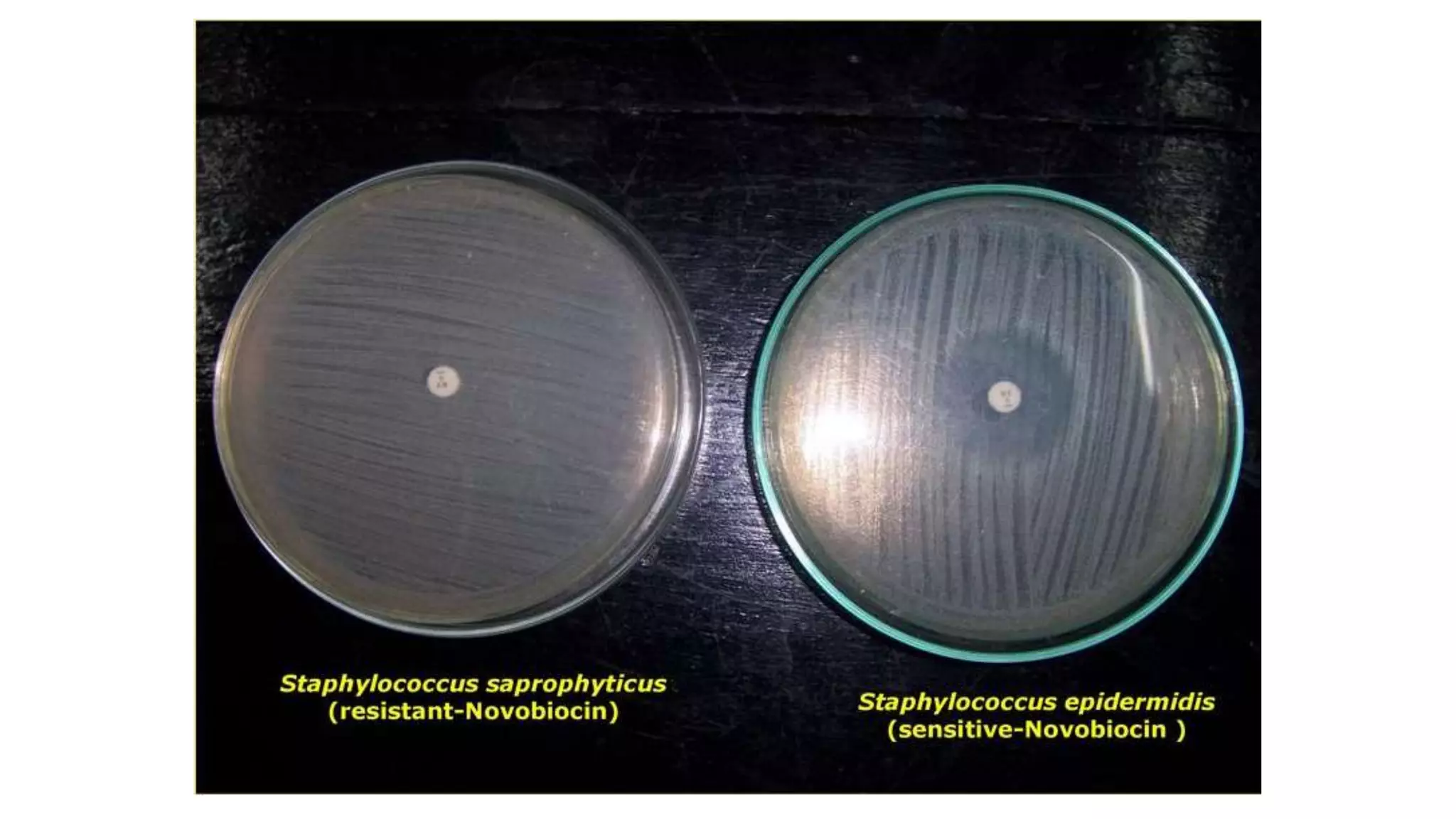 Staph epidermidis and saprophyticus | PPTX