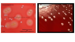 Staph epidermidis and saprophyticus | PPTX