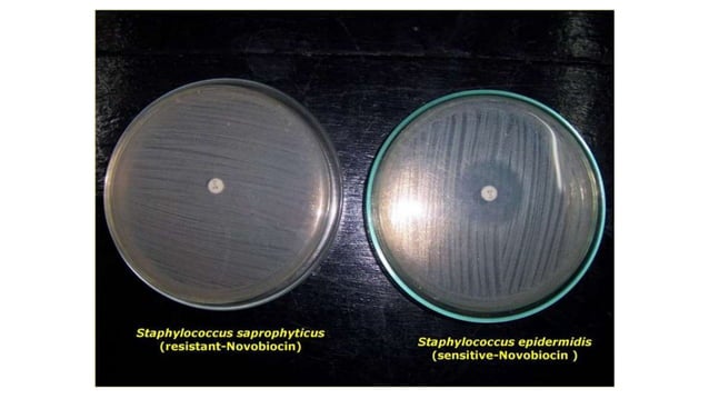 Staph epidermidis and saprophyticus | PPTX