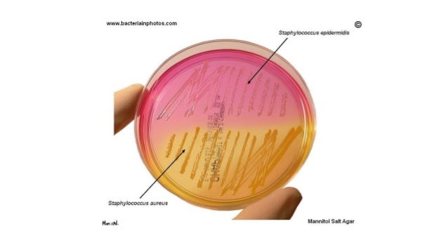 Staph epidermidis and saprophyticus