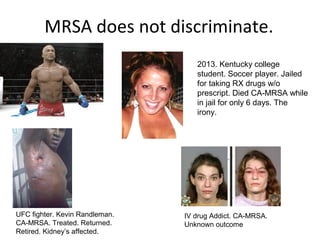 MRSA Does Not Discriminate | PPT