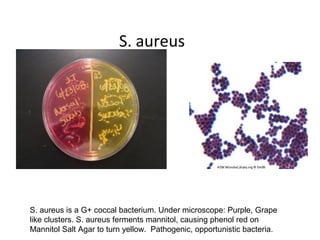 Mrsa Bacteria Under Microscope