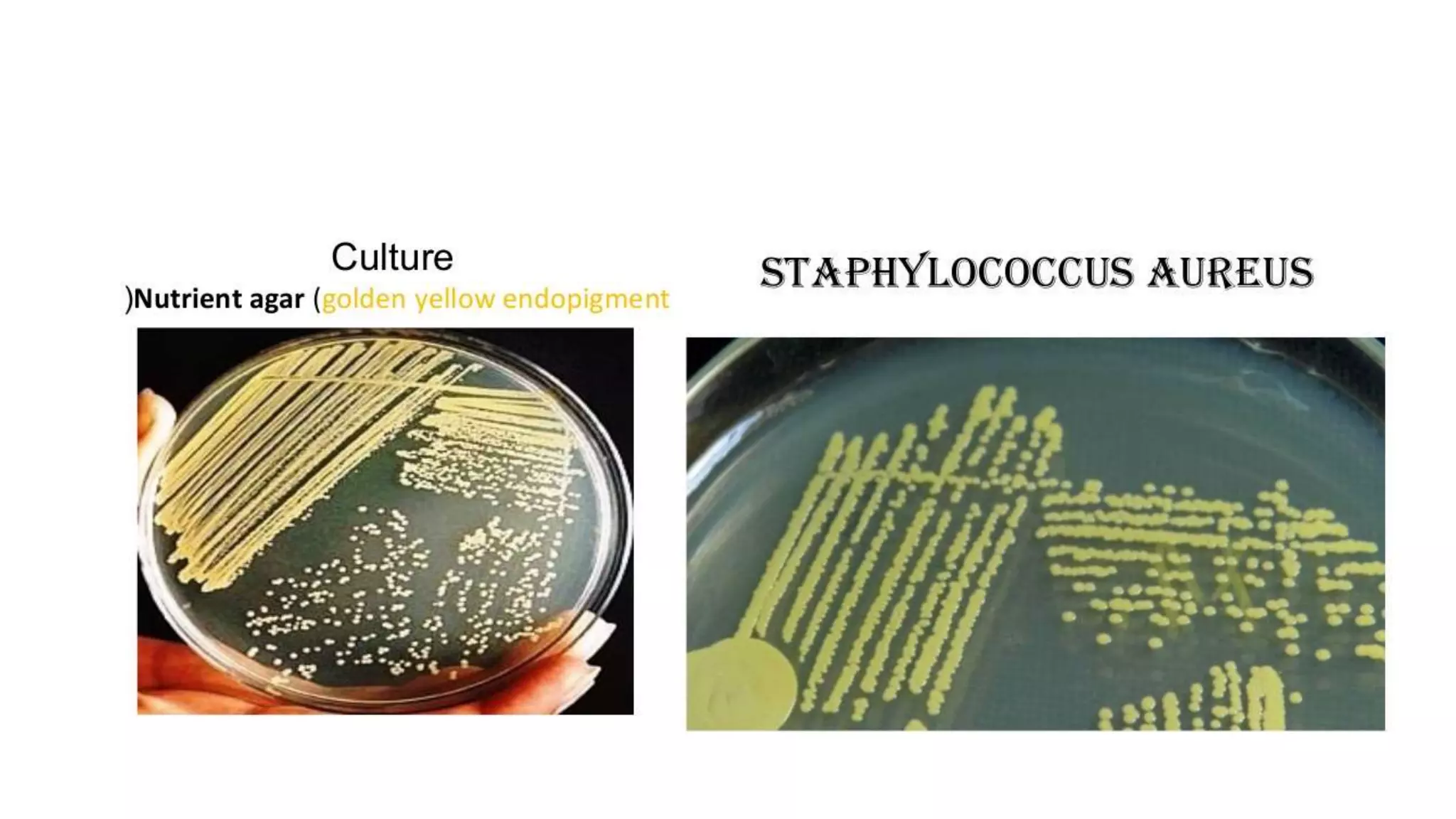 staphylococcus streptococcus revision notes microbiology | PPTX