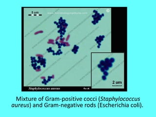 Staphylococcus Spp | PPTX