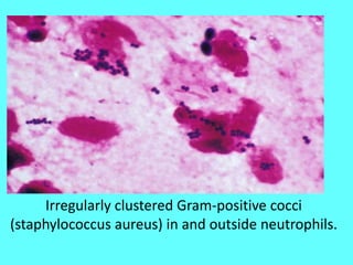 Staphylococcus Spp | PPTX