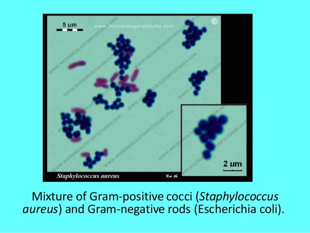 Staphylococcus Spp