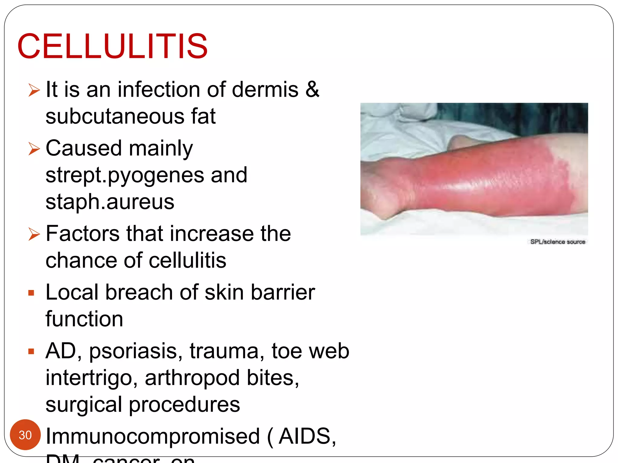 Staphylococcal & streptococcal skin infections | PPTX