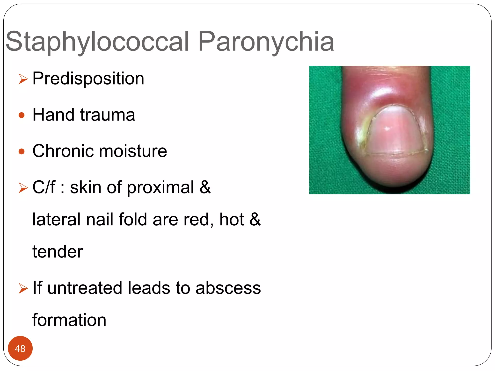 Staphylococcal & streptococcal skin infections | PPTX | Ear, Nose and ...