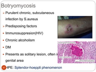 Staphylococcal & streptococcal skin infections | PPTX