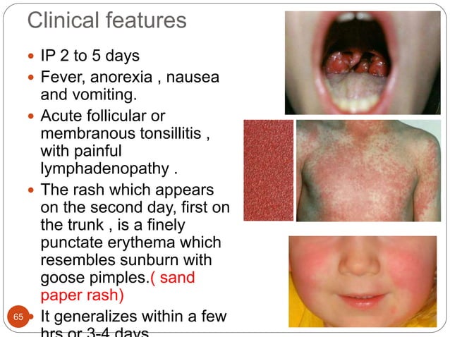 Staphylococcal & streptococcal skin infections | PPT
