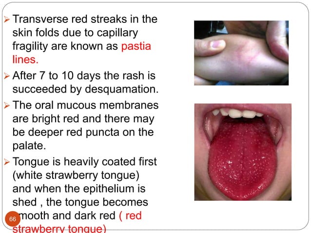 Staphylococcal & streptococcal skin infections | PPT
