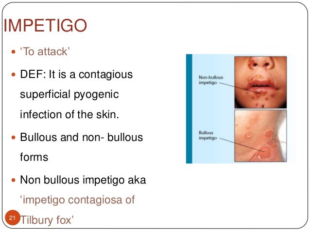 Staphylococcal & streptococcal skin infections
