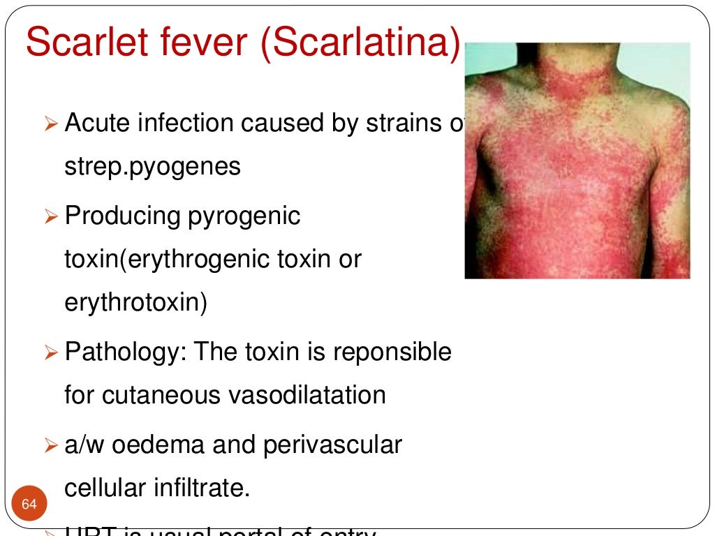 Staphylococcal & streptococcal skin infections
