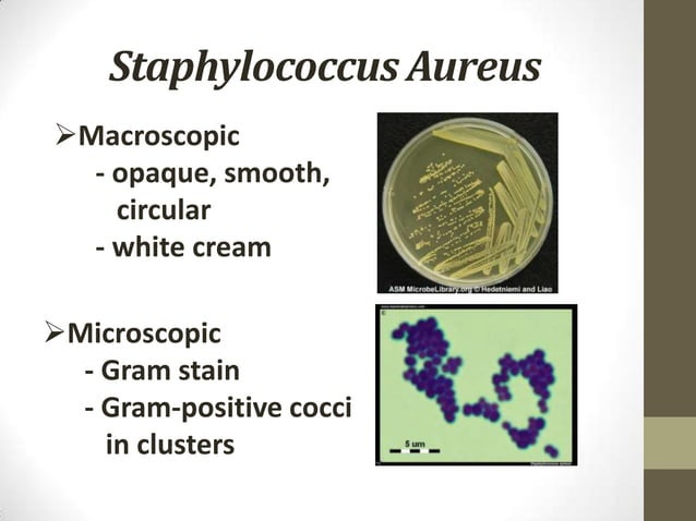 Staphylococcal food poisoning | PPT
