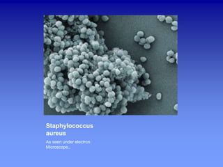 Staphylococcal skin infections by dr, Hari dagal | PPT