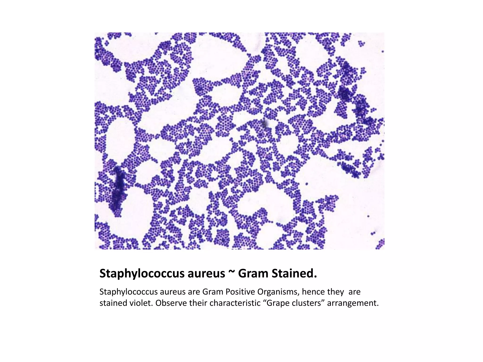 Staphylococcal Skin Infections | PPTX