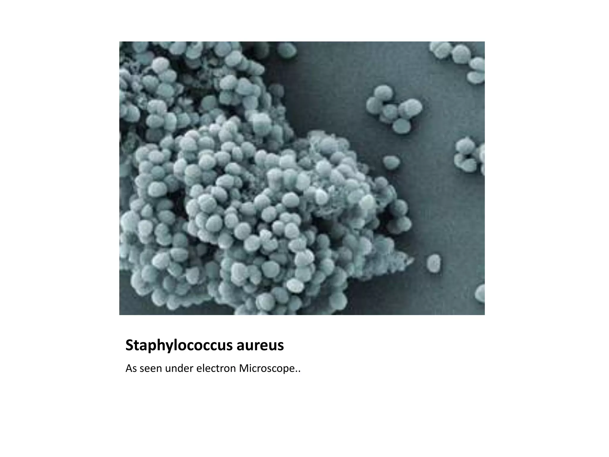 Staphylococcal Skin Infections | PPTX
