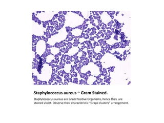 Staphylococcal Skin Infections | PPTX