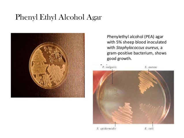 Phenylethyl Alcohol Agar Licorice Extract Infused Electrospun