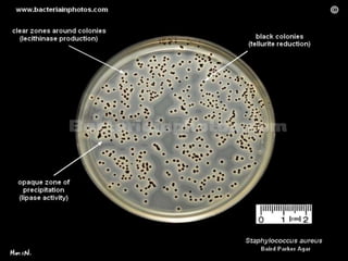 Staphylococci.pptx