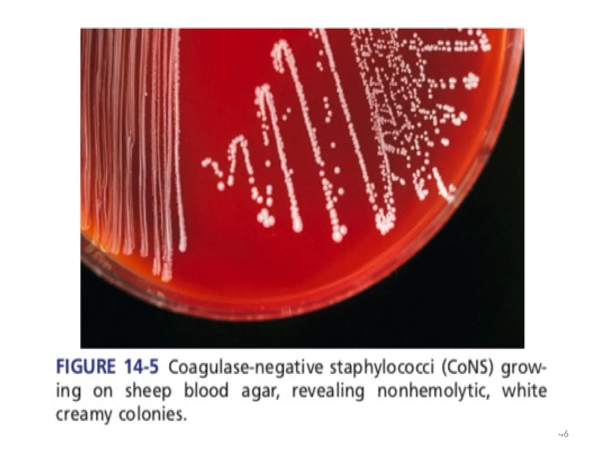 STAPHYLOCOCCI bacteria which is negative and its effect | PPT