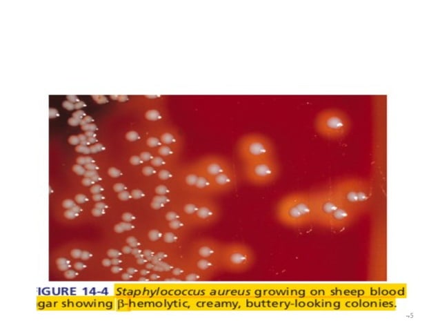 STAPHYLOCOCCI bacteria which is negative and its effect | PPT
