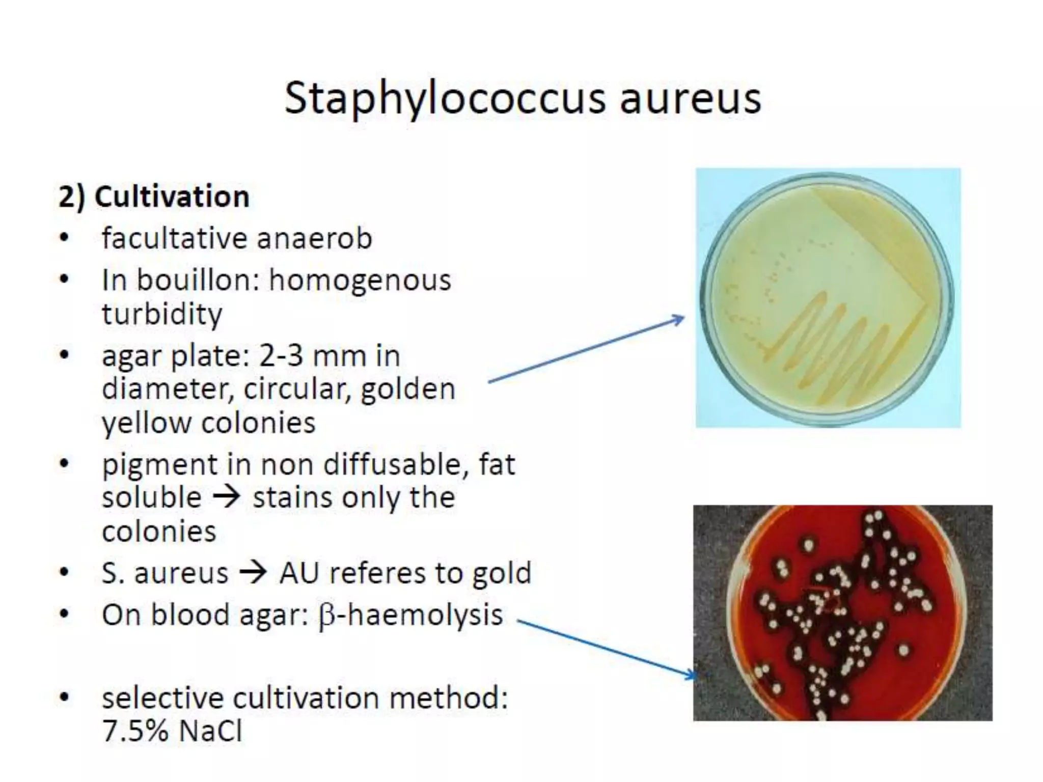Staphylococci and Streptococci (1).pptx