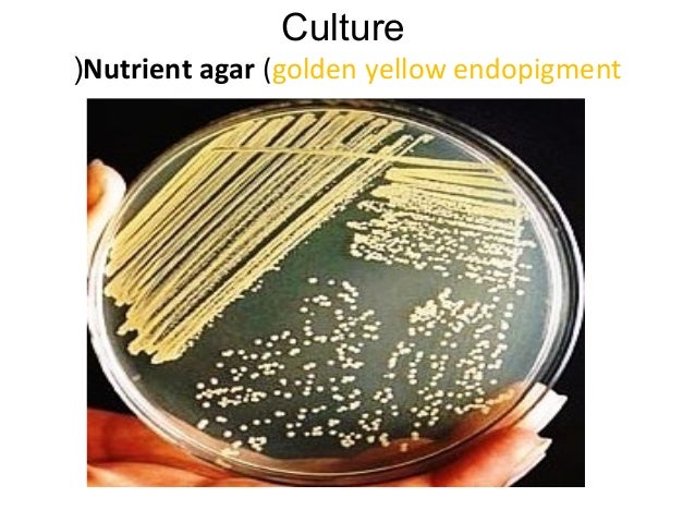 Oxoid Cm0003 Nutrient Agar 500 Gr Shopee Indonesia