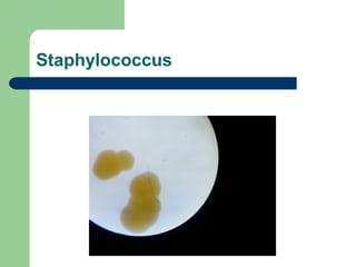 Staphylococcus | PPT