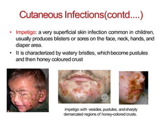 STAPHYLOCOCCUS | PPTX