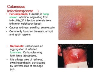 staphylococcus-131009035940-phpapp01 (1).pptx