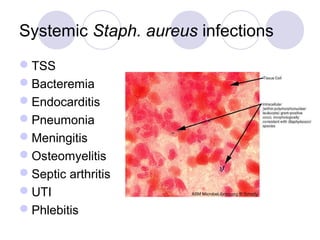 Staphylococcus | PPT