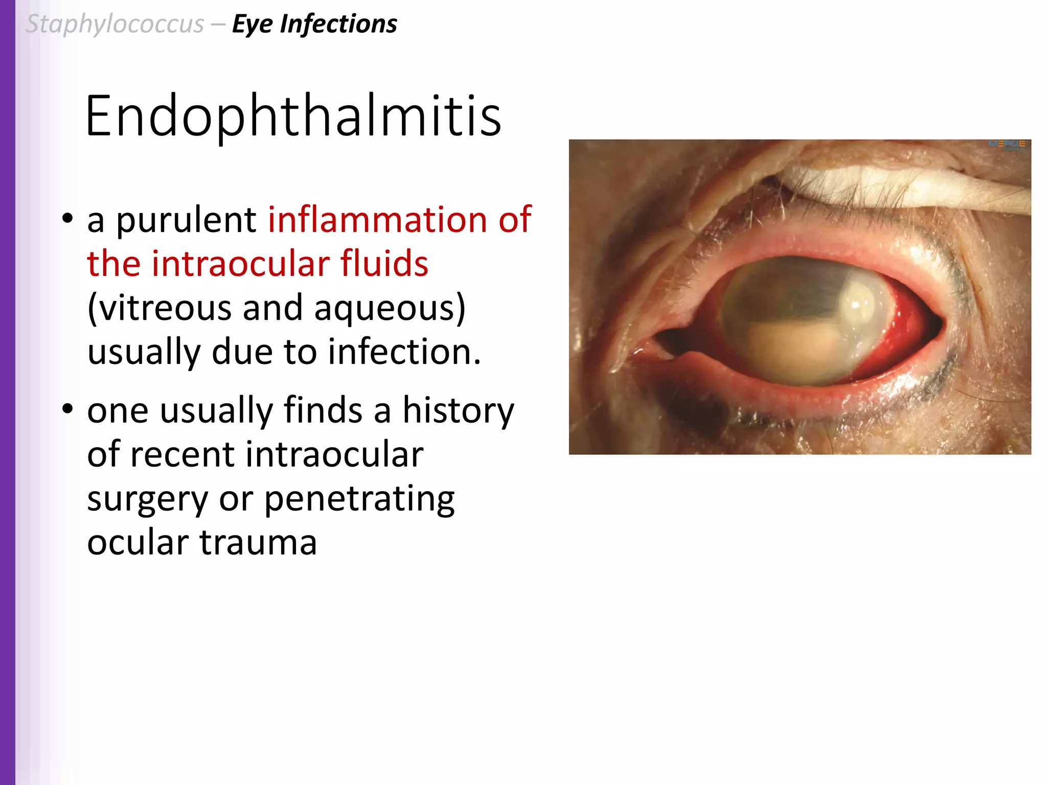 Staphylococcus | PDF