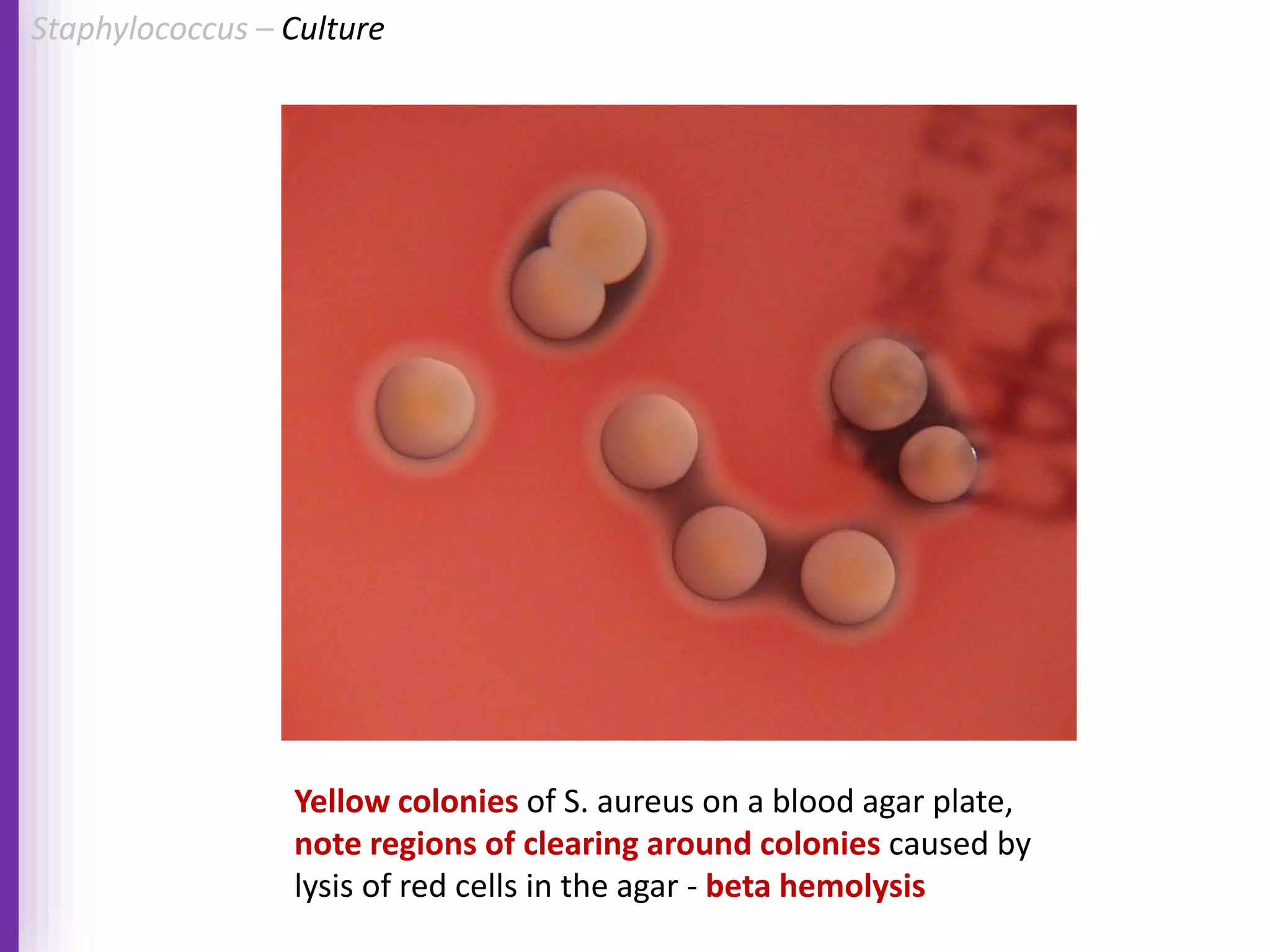 Staphylococcus | PDF