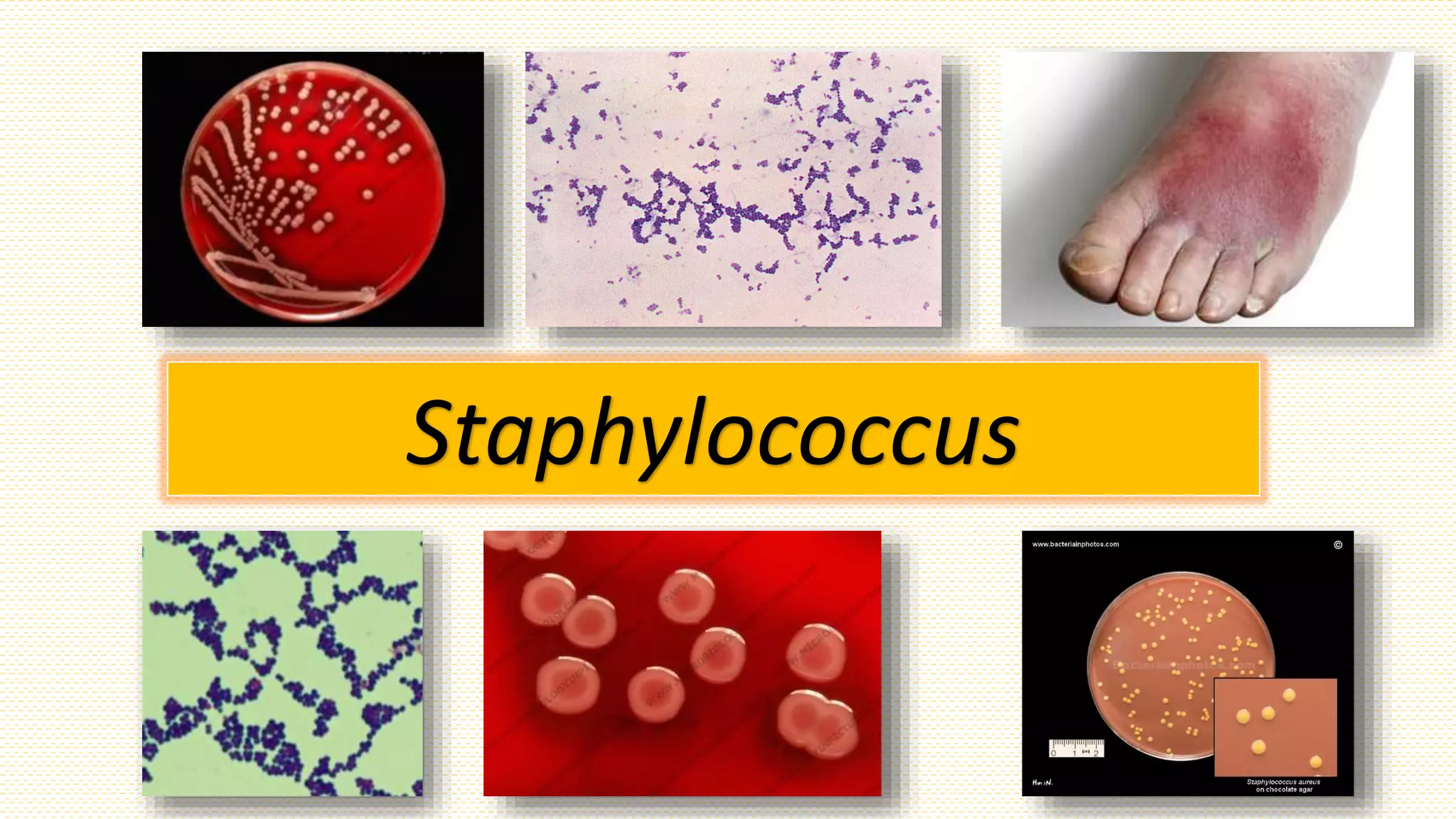 Staphylococcus | PPTX