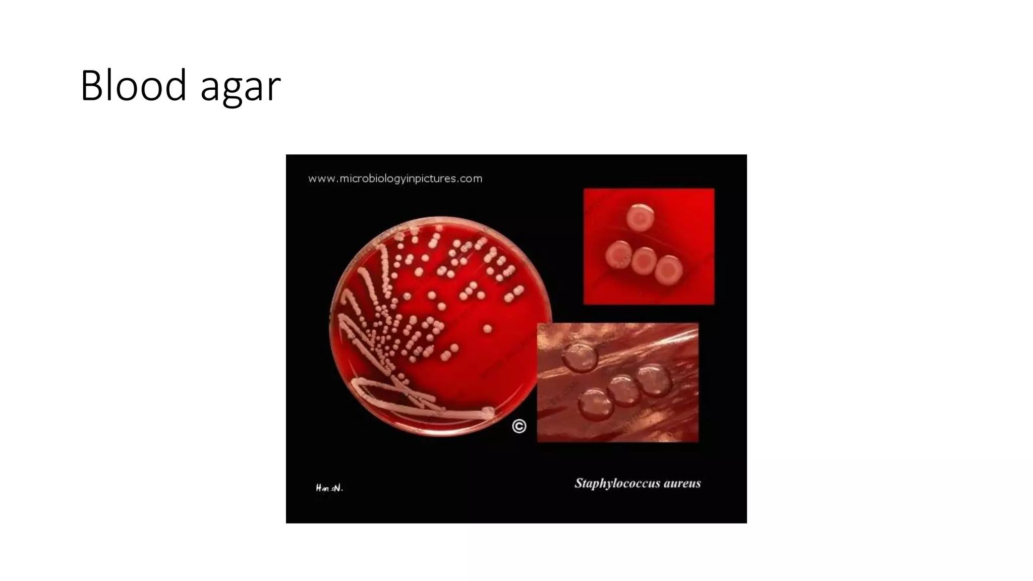 Staphylococcus | PPTX