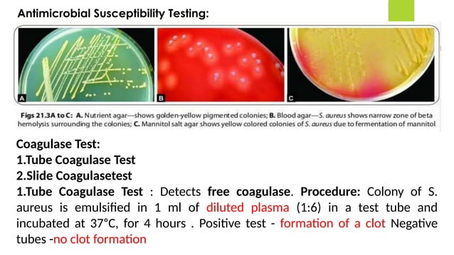 Staphylococcus streptococcus their toxins, diagnosis and treatment | PPTX