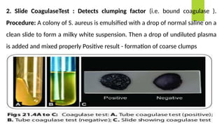 Staphylococcus streptococcus their toxins, diagnosis and treatment | PPTX