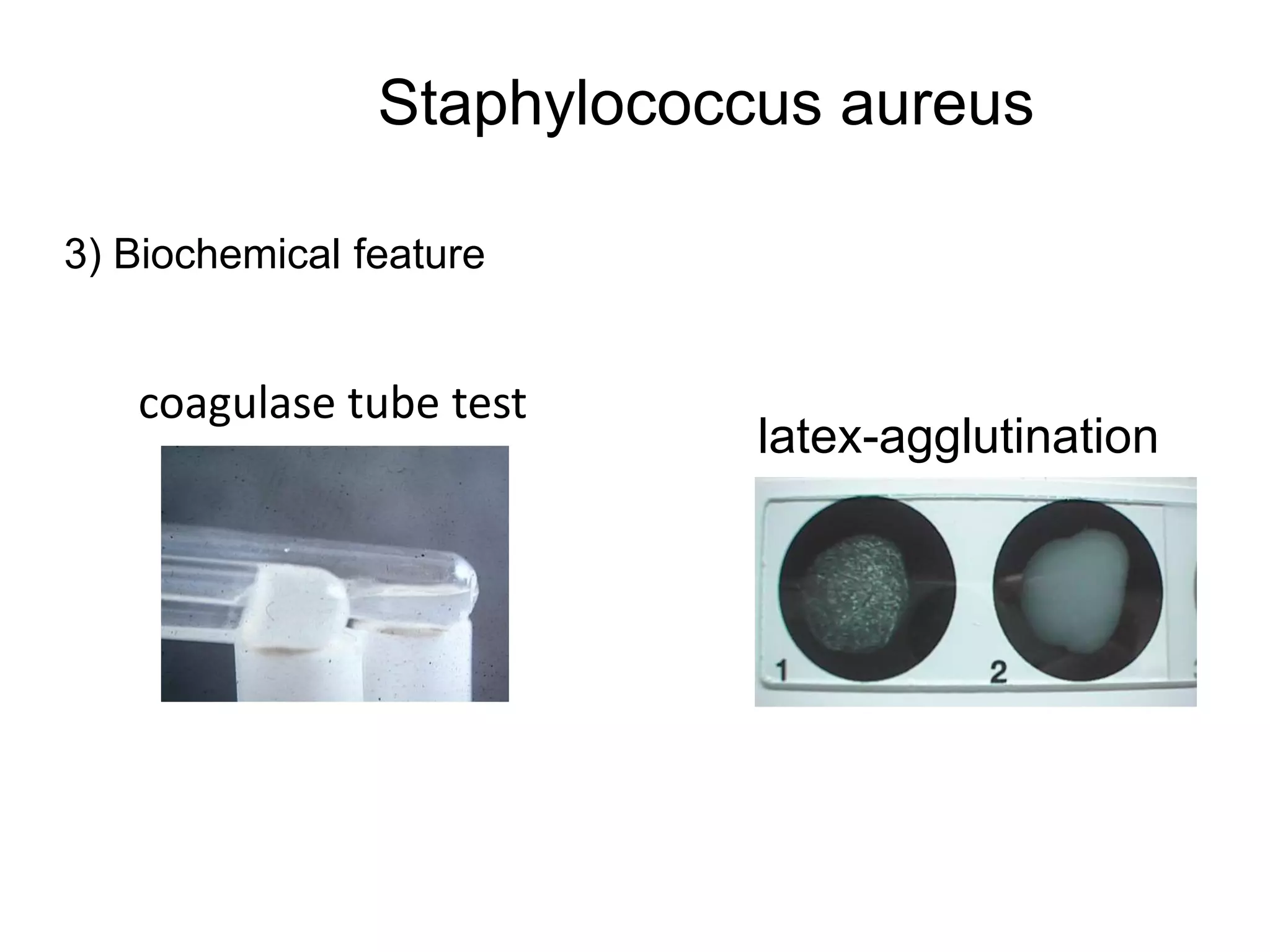 Staphylococcus.pdf