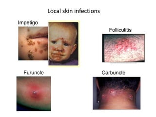 Staphylococcus.pdf