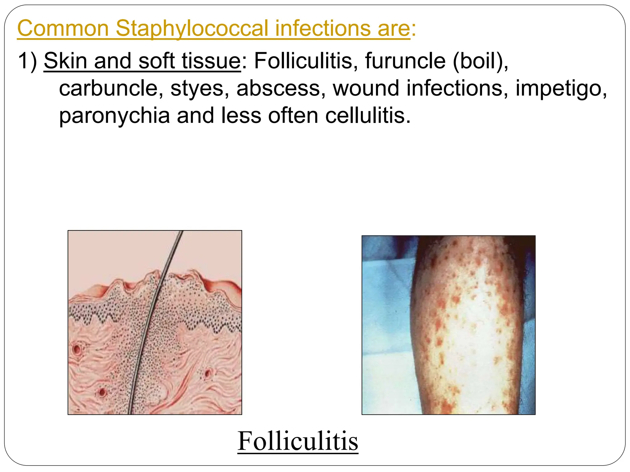 Staphylococcus.ppt.........ali.rasool.badr