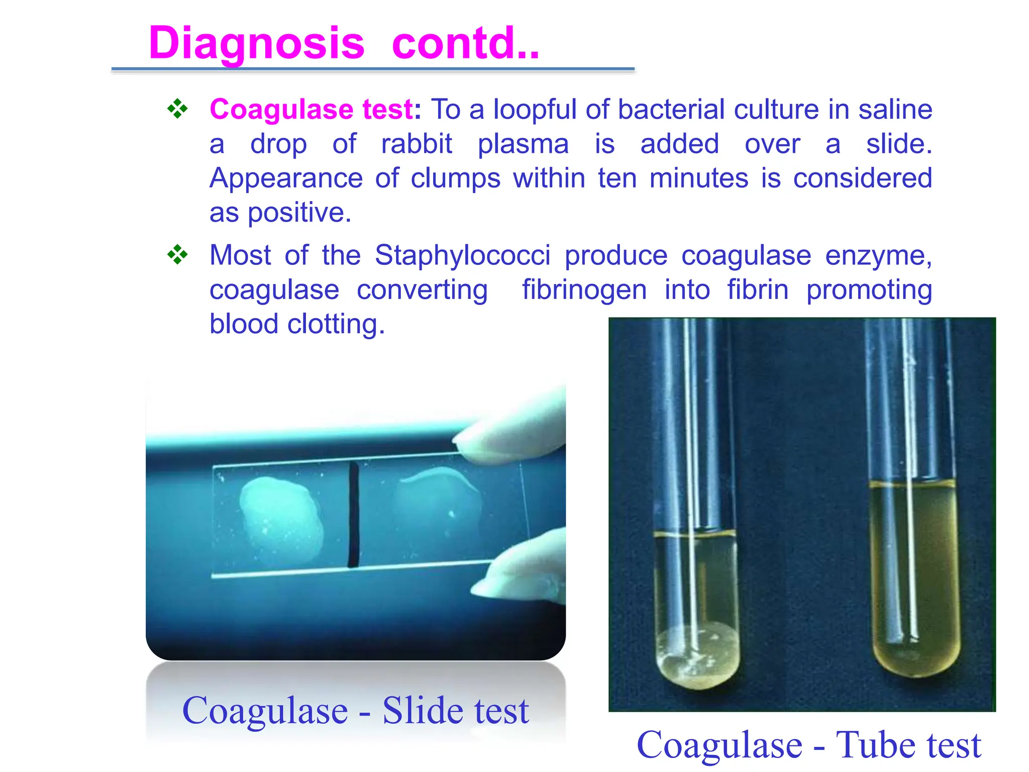Staphylococcus.ppt veterinary microbiology | PPT