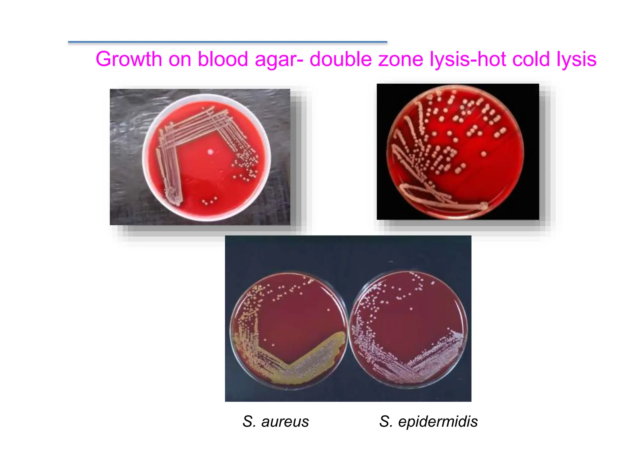 Staphylococcus.ppt veterinary microbiology | PPT