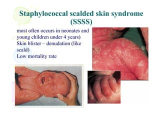 STAPHYLOCOCCUS.spp. (3).pdfSTAPHYLOCOCCUS MICROBIOLOGICAL ...
