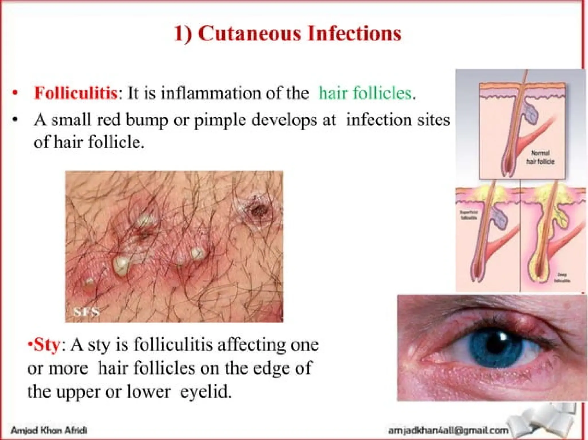 staphylococcus-256712602.pdf