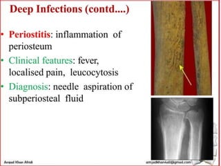 staphylococcus-256712602.pdf