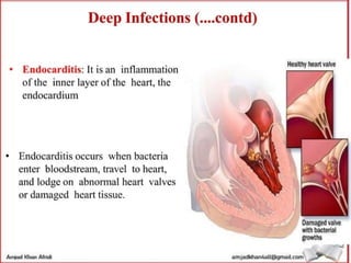 staphylococcus-256712602.pdf