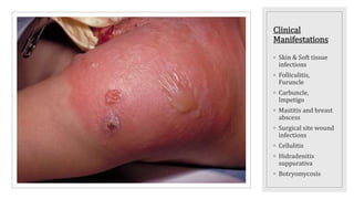 Staphylococcus Dr.Ashna Ajimsha | PPT